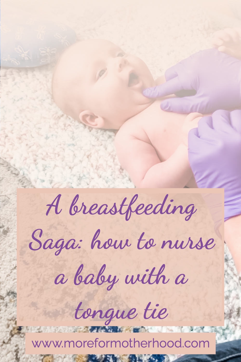 A Breastfeeding Saga How To Nurse A Baby With A Tongue Tie More For